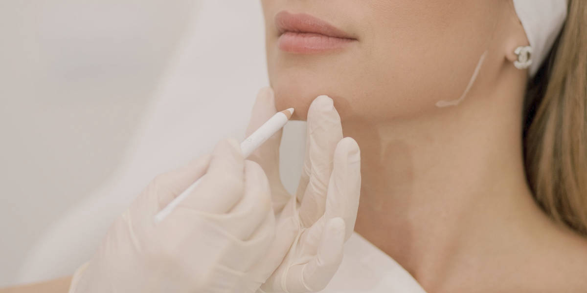 Chin Filler in London - Fitzrovia Clinic